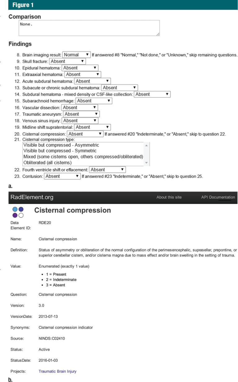 Radiology Report Template S Cbct Sample Page 791X1024 E2 80 in ...